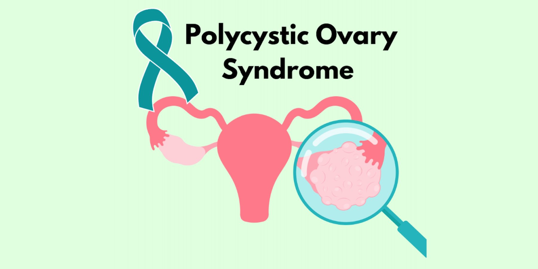 Demystifying PCOS: Symptoms, Causes, and Effective Management | Assuaged